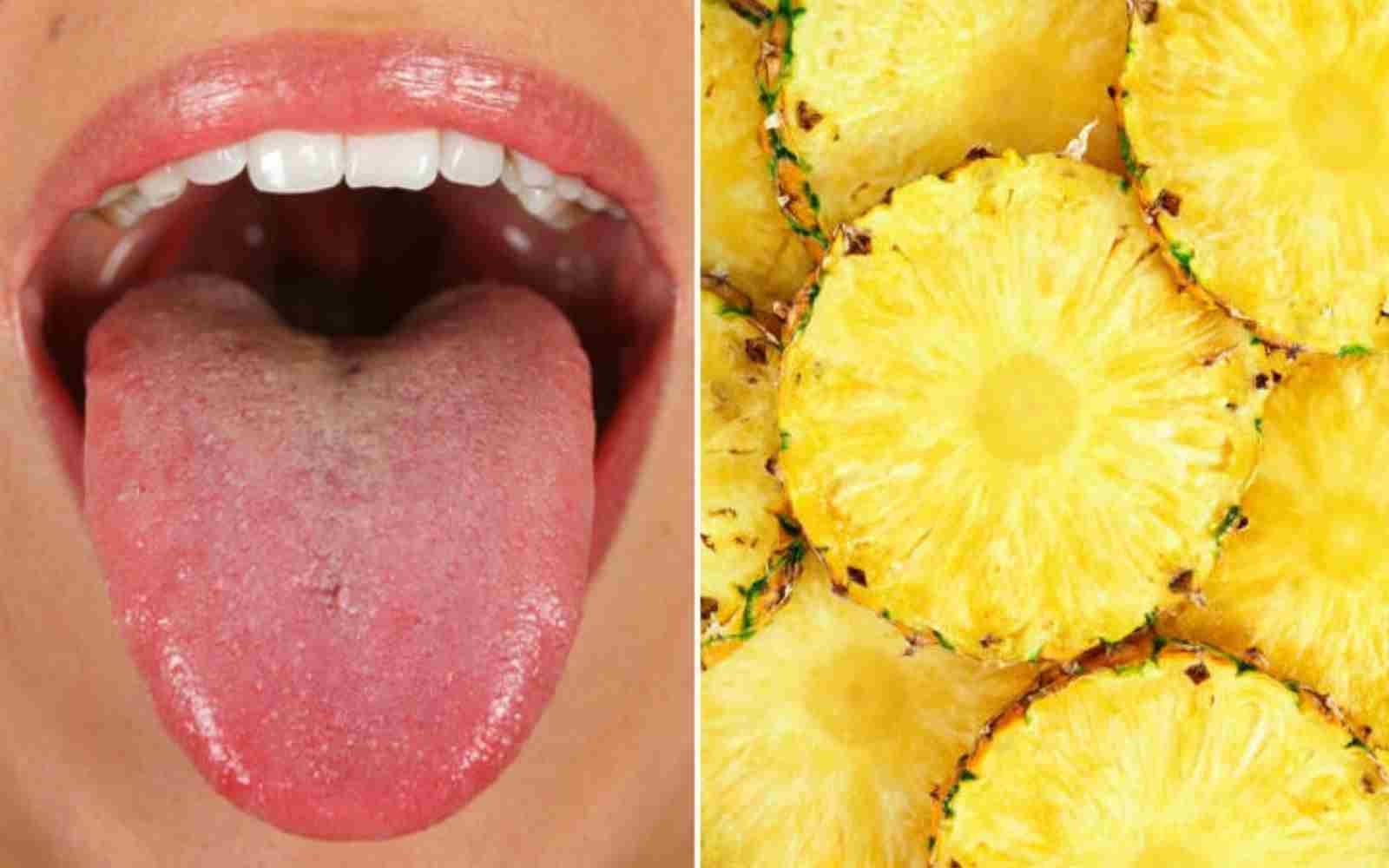 ¿Por qué pica comer piña? - Fama FM